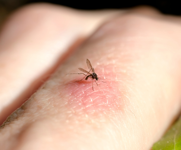 aedes mosquito bite mark