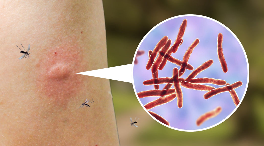 Buruli Ulcer: How Possum Poo & Mozzies Are Spreading The Disease ...