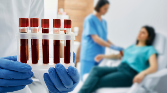 Check Your Iron Levels: Blood Tests You Should Know About – Aussie ...