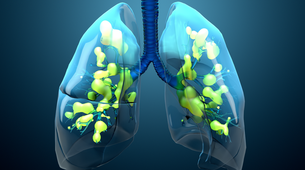 How to Get Rid of Mucus in Lungs Fast, The Natural Way – Aussie Pharma ...
