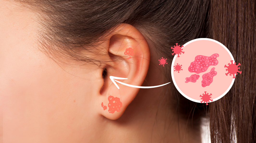 Is It Normal to Have Dry Ears? Exploring Causes and Treatments – Aussie ...