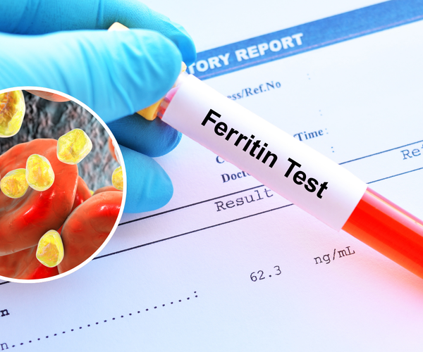 Low Ferritin, Normal Iron: What Your Blood Test Might Be Telling You ...