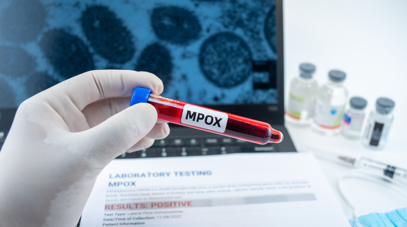 Stay Safe from Mpox: Benefits of ViroCLEAR in Disinfection & Hygiene ...