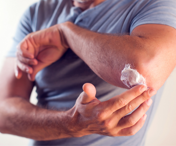 What is a Barrier Cream and How to Use It? – Aussie Pharma Direct