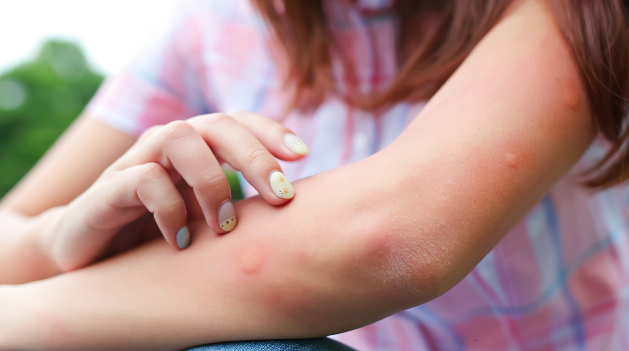 Your Ultimate Guide to Finding the Right Insect Repellent – Aussie ...