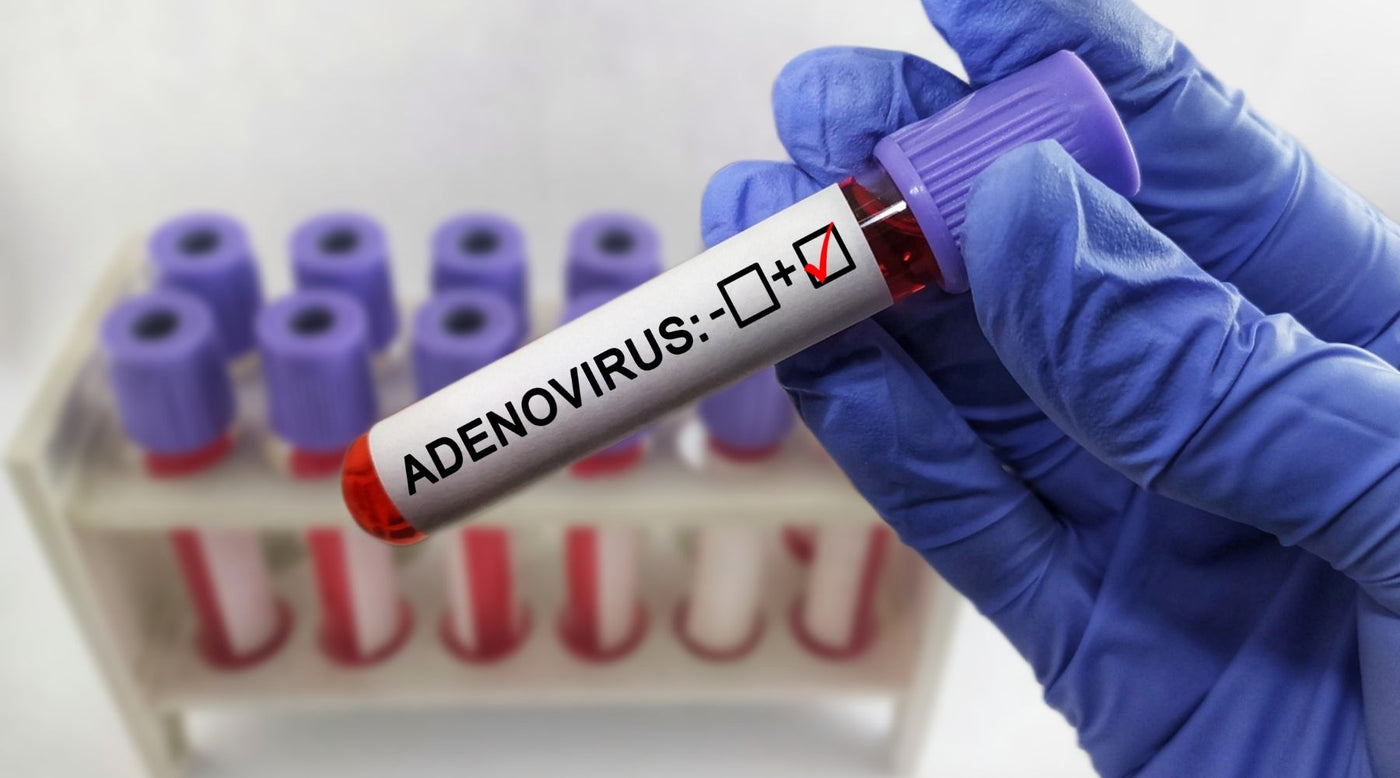 What is Adenovirus (AdV)? Its Impact, Symptoms & How to Treat It ...