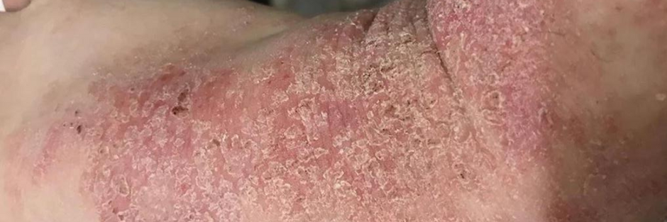 Shop Allay Organics I For Skin & Scalp – Aussie Pharma Direct